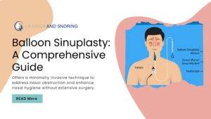 What is Balloon Sinuplasty: A Comprehensive Guide - LA Sinus and Snoring